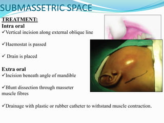 SPACE INFECTIONS-TYPES, DIAGNSOSIS AND MANAGEMENT | PPTX