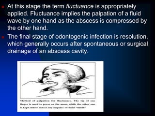 Fascial Space infection | PPTX