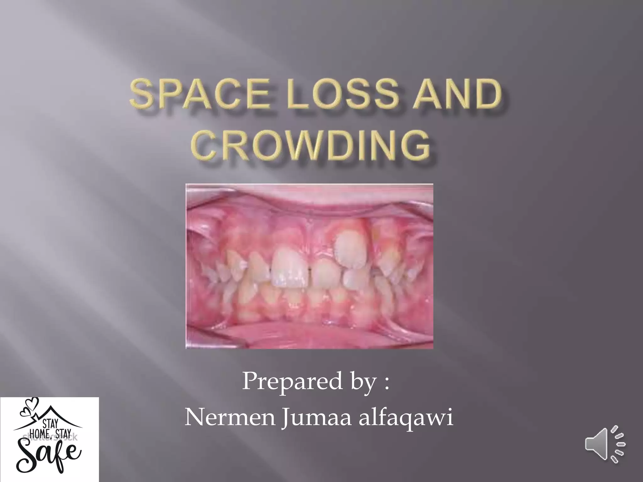 Space loss and crowding | PPTX
