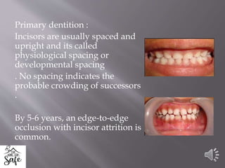 Space loss and crowding | PPTX