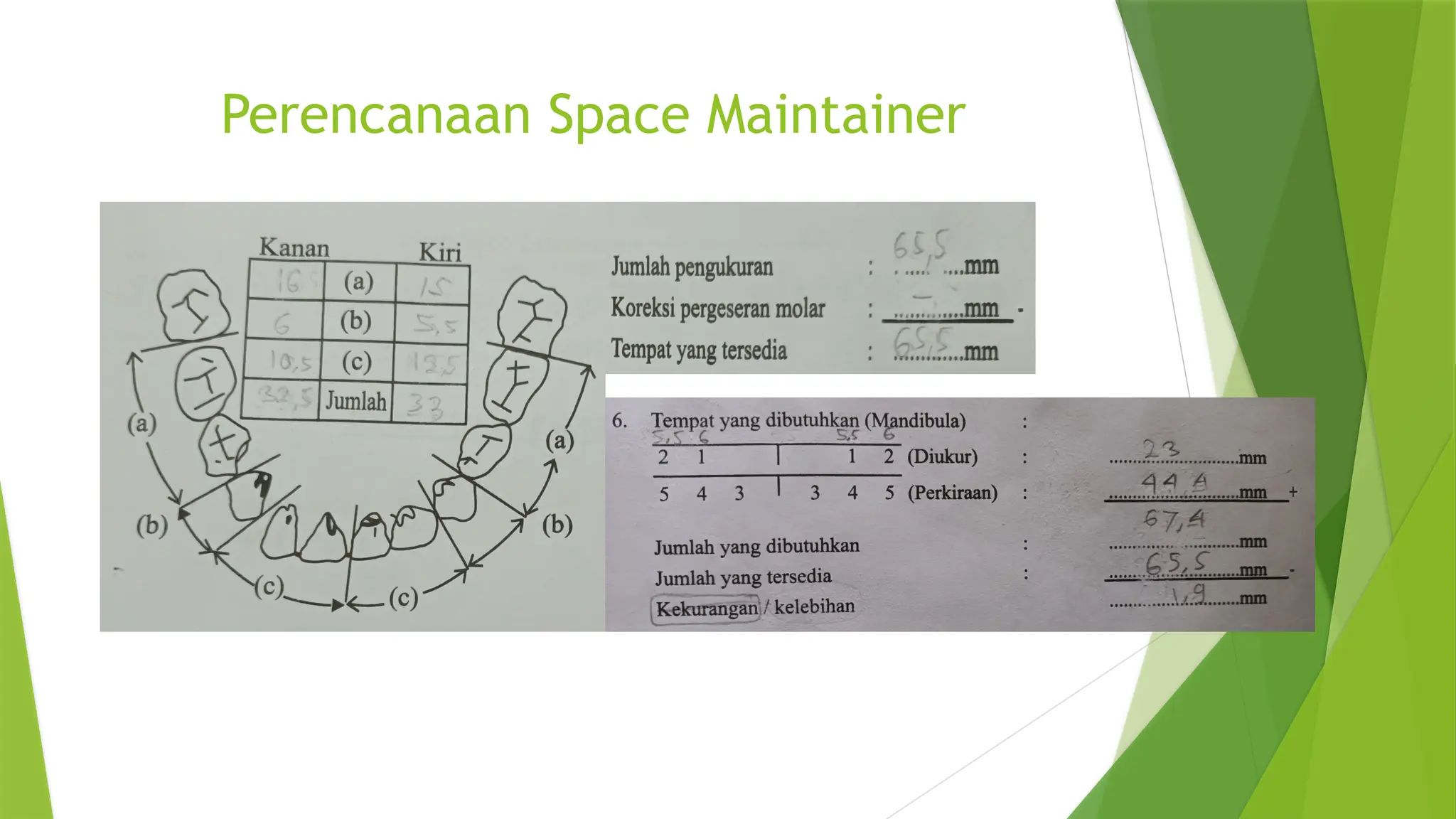 PPT Presentasi Space Maintainer penjelasan.pptx