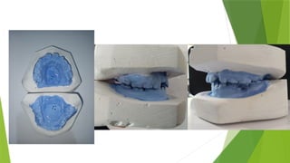 PPT Presentasi Space Maintainer penjelasan.pptx