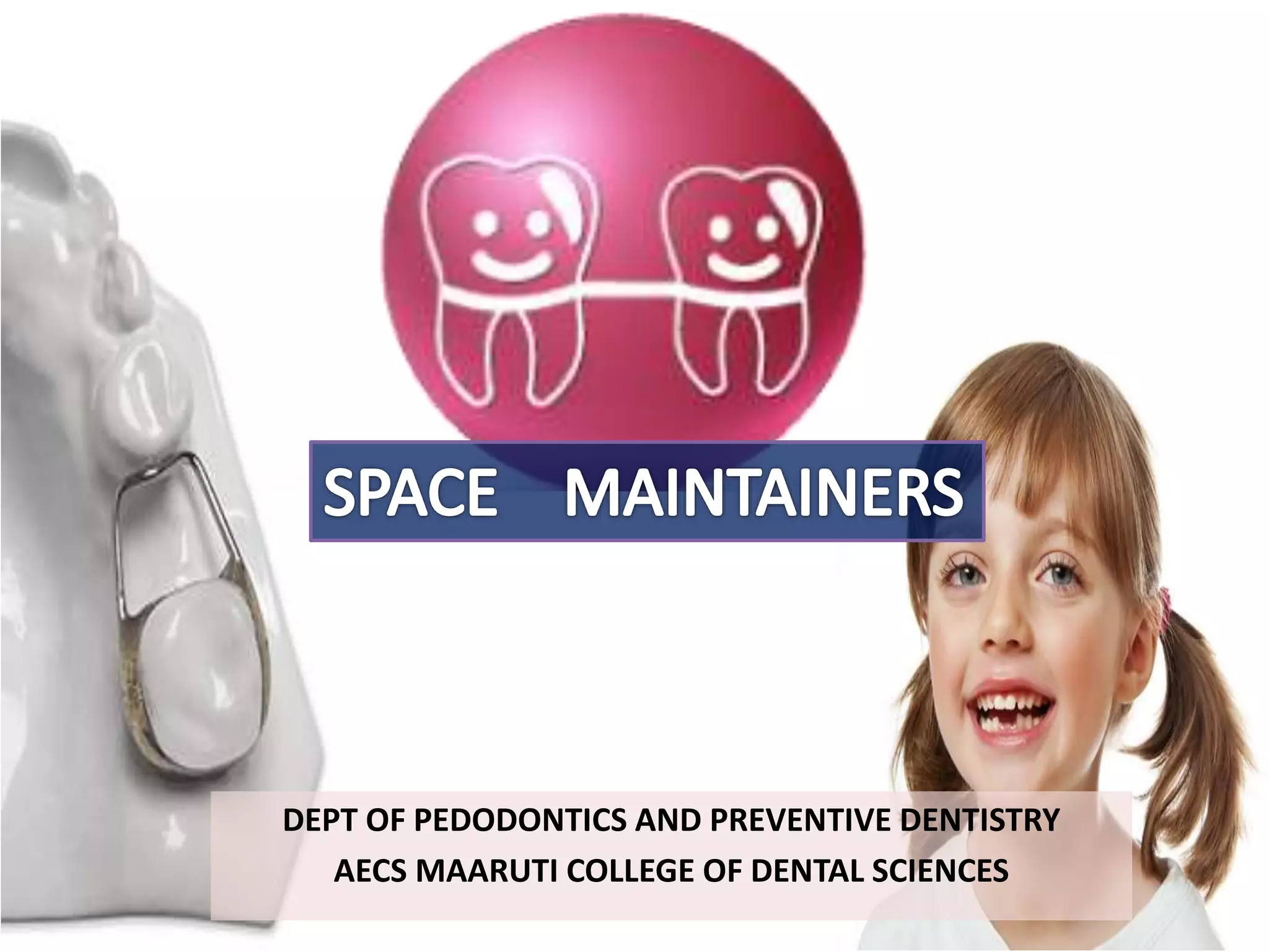 Space maintainers | PPTX