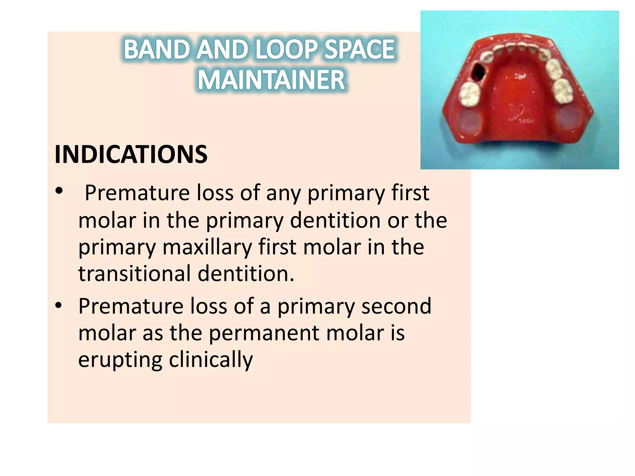 Space maintainers | PPTX