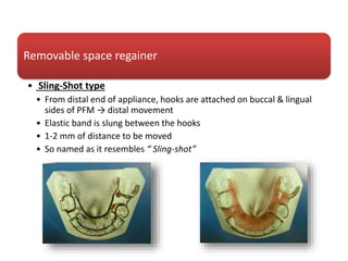 Space maintainers | PPT