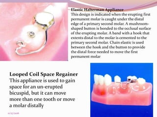Space maintainers | PPTX