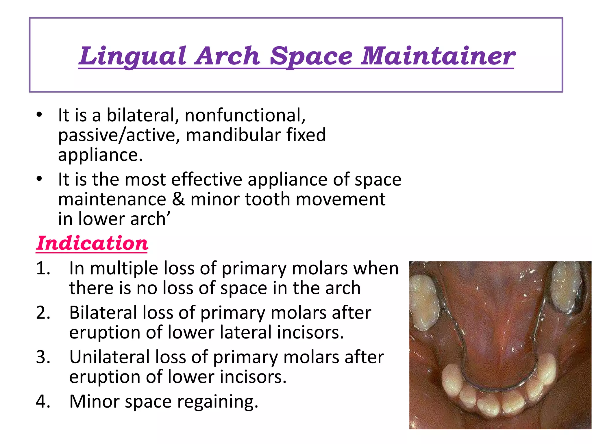 Space maintainers | PPTX
