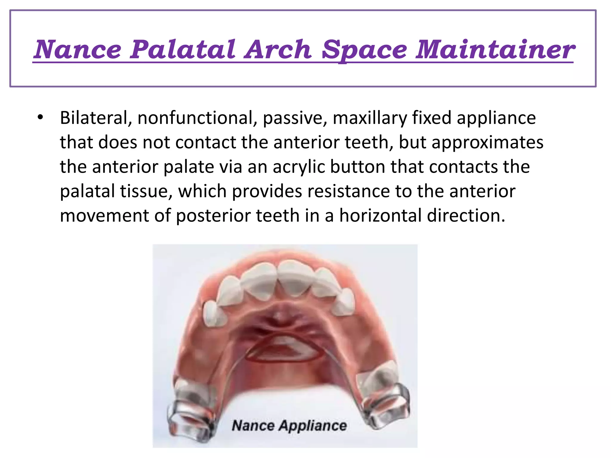 Space maintainers | PPTX