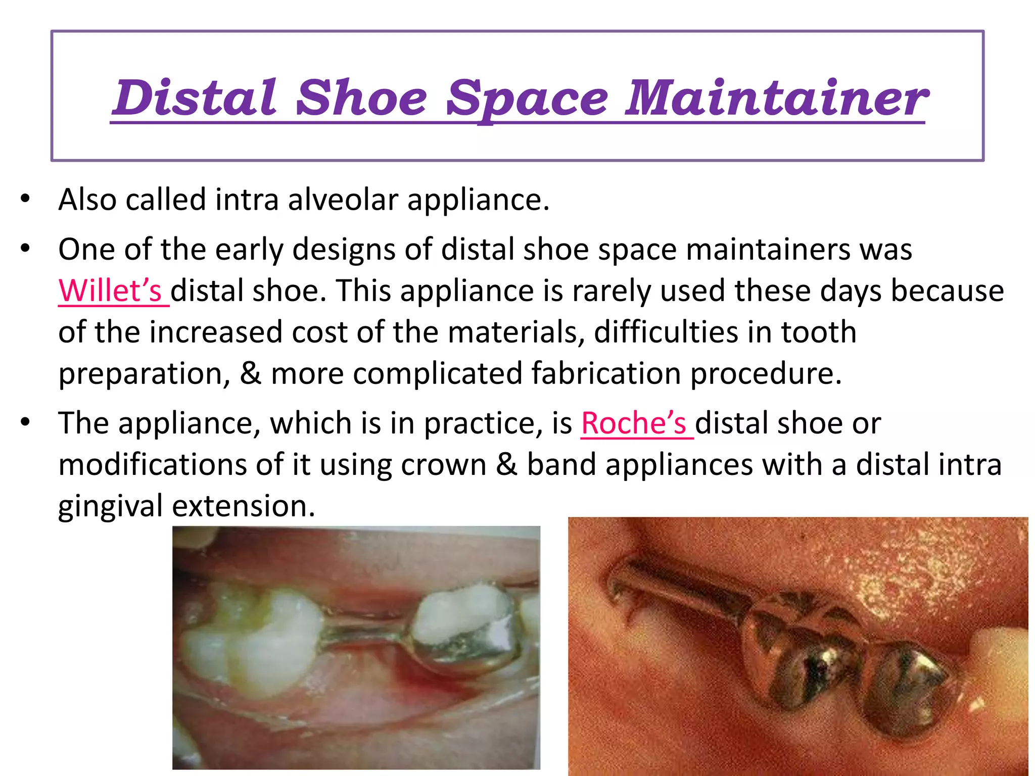 Space maintainers | PPTX