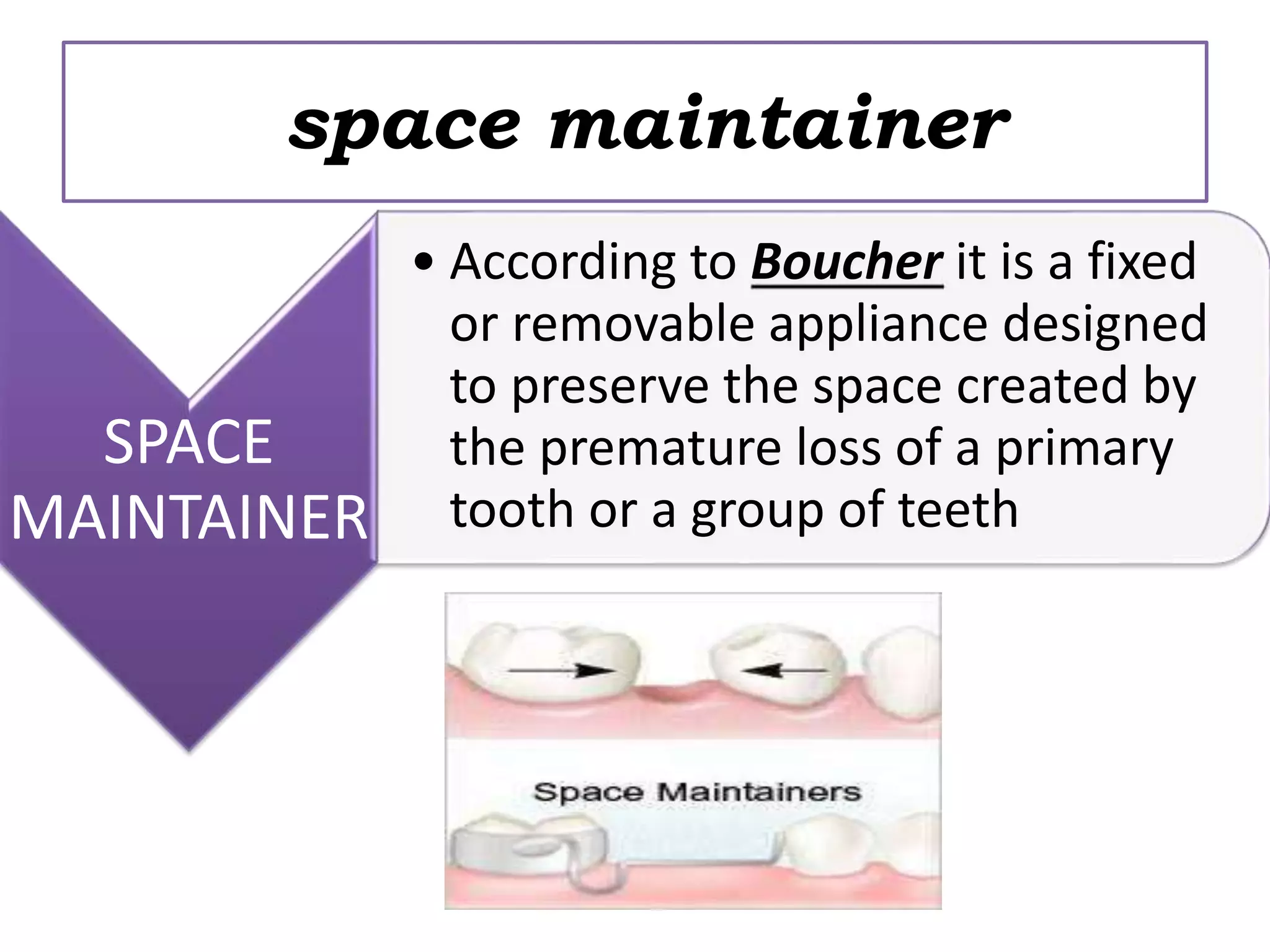 Space maintainers | PPTX