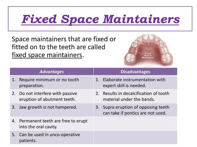 Space maintainers | PPTX