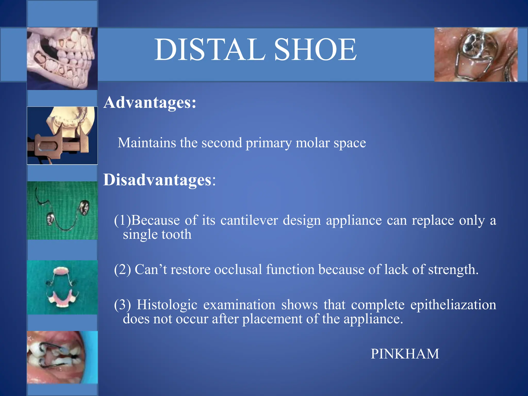 space maintainers in primary and mixed dentition .pptx