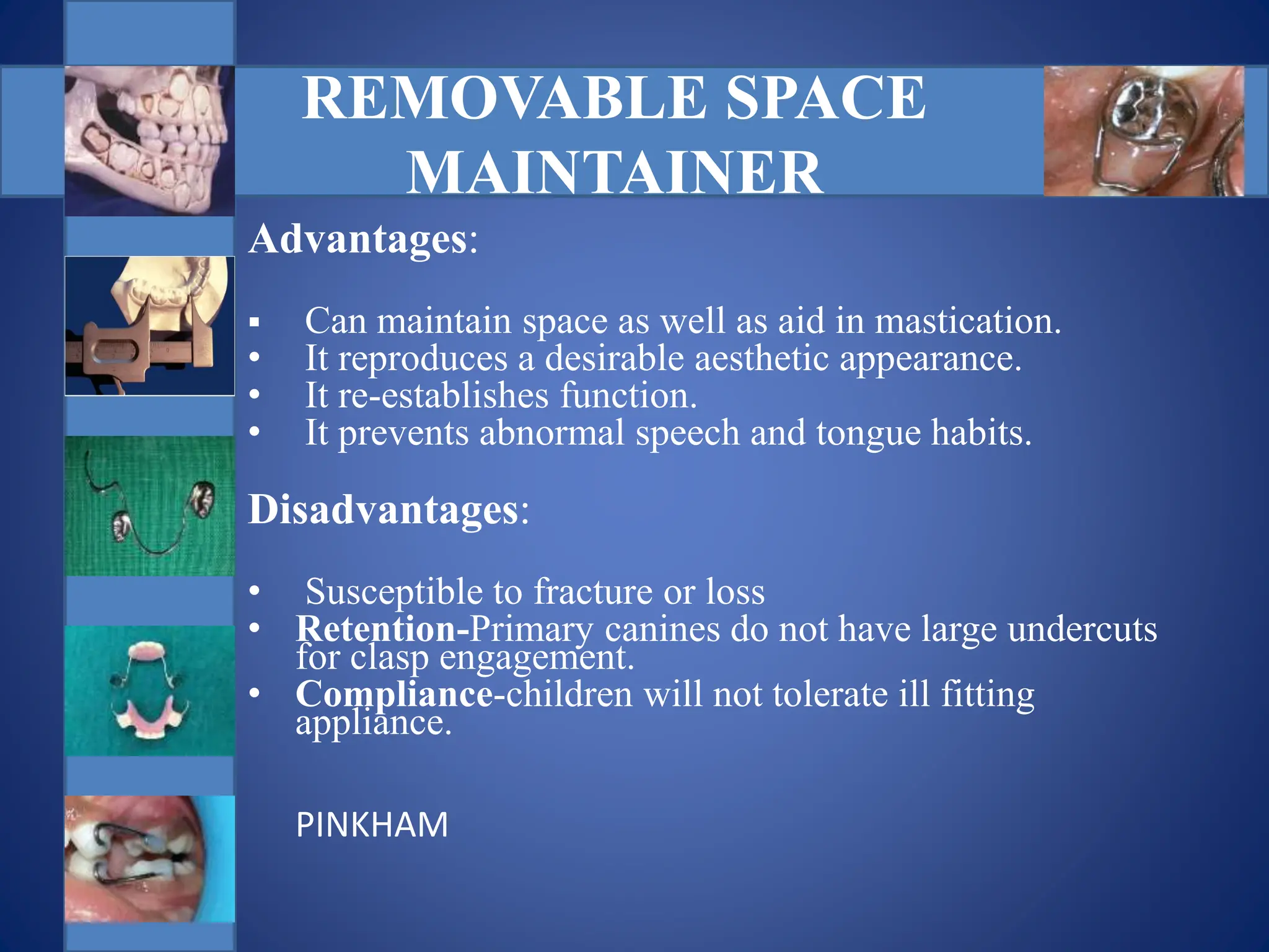 space maintainers in primary and mixed dentition .pptx