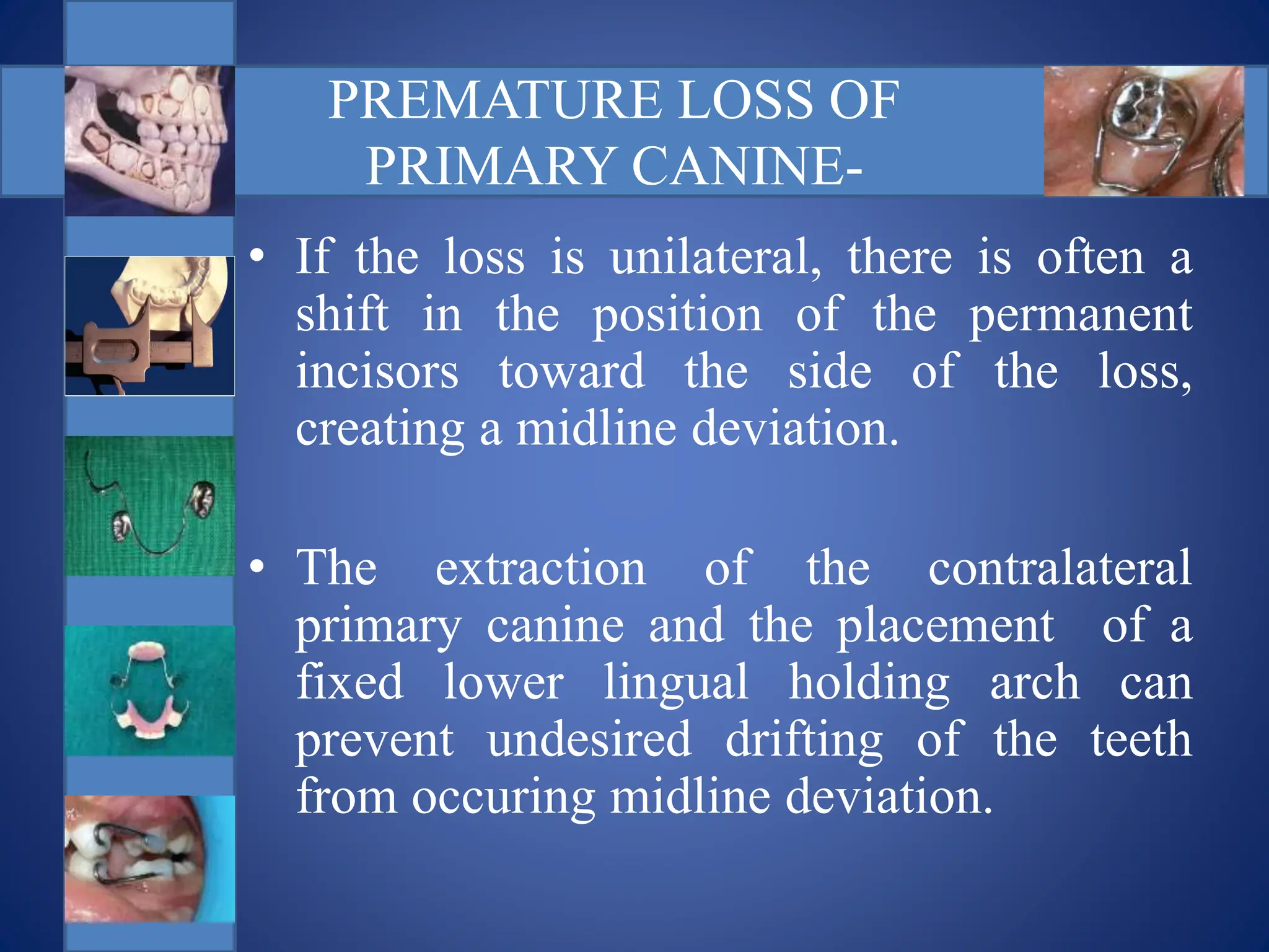 space maintainers in primary and mixed dentition .pptx