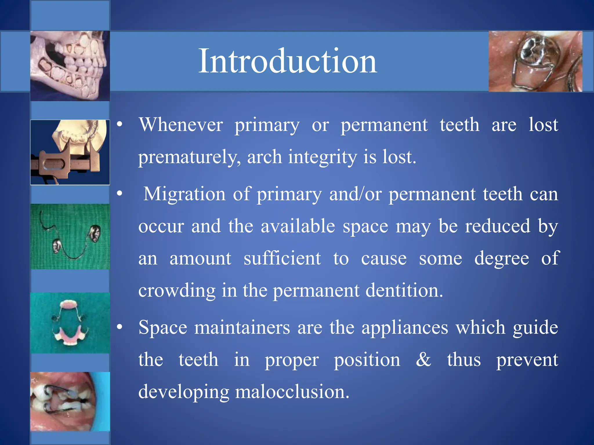 space maintainers in primary and mixed dentition .pptx
