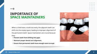 Space Maintainers in Pediatric Dentistry.pptx