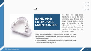 Space Maintainers in Pediatric Dentistry.pptx