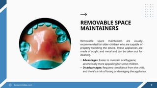 Space Maintainers in Pediatric Dentistry.pptx