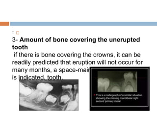 space maintaner in pedodontic clinic.pptx