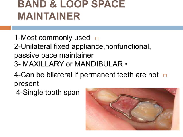 space maintaner in pedodontic clinic.pptx