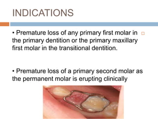 space maintaner in pedodontic clinic.pptx