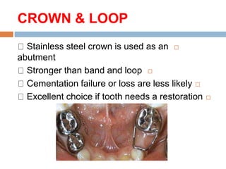 space maintaner in pedodontic clinic.pptx