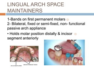 space maintaner in pedodontic clinic.pptx