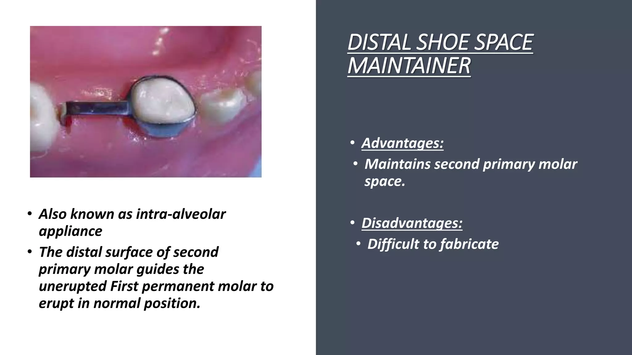 Fixed and Removable Space maintainers in orthodontics | PPTX