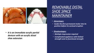 Fixed and Removable Space maintainers in orthodontics | PPTX