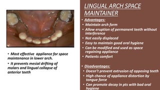 Fixed and Removable Space maintainers in orthodontics | PPTX