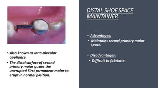 Fixed and Removable Space maintainers in orthodontics | PPTX
