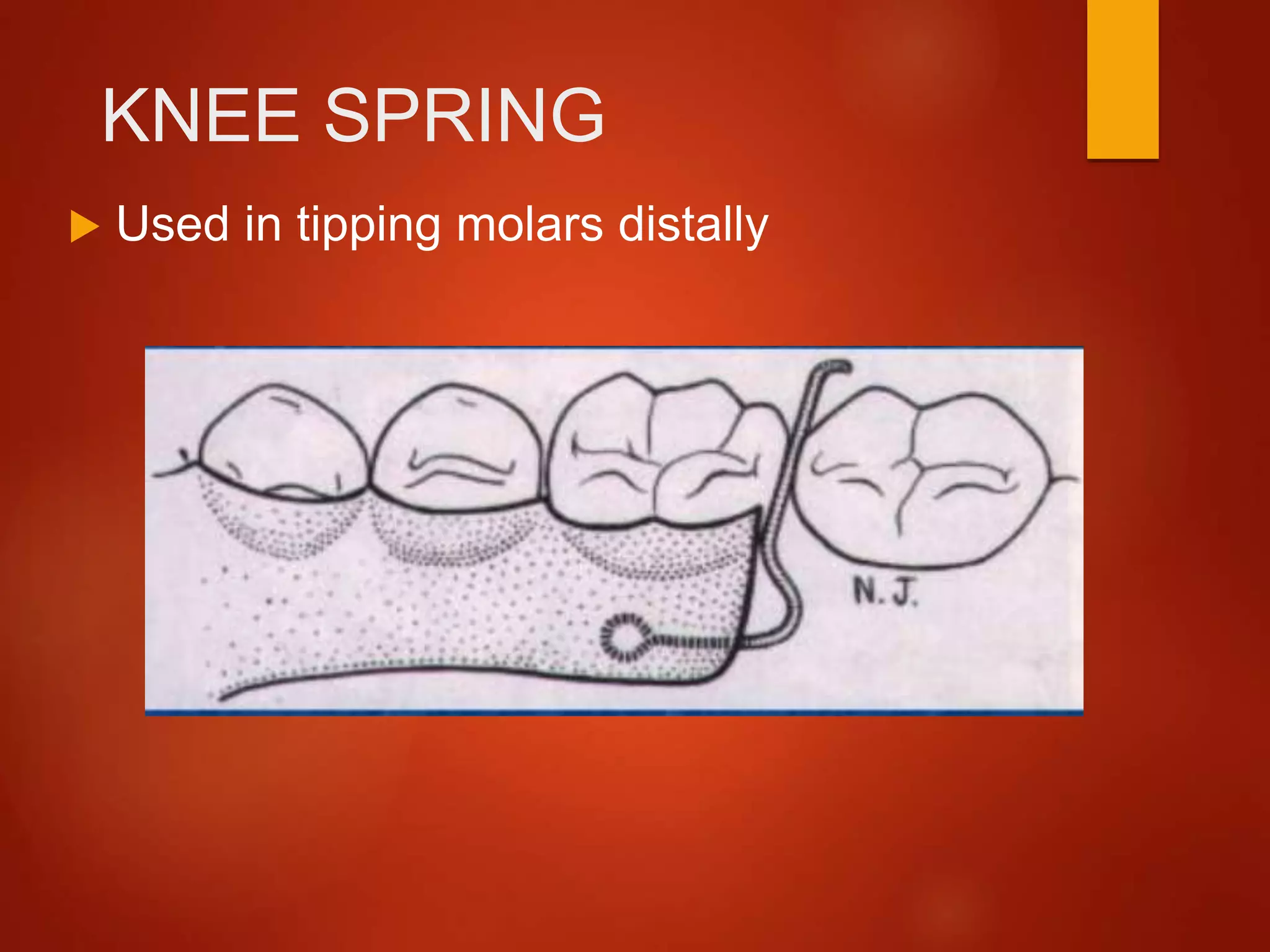 Space regainers | PPTX