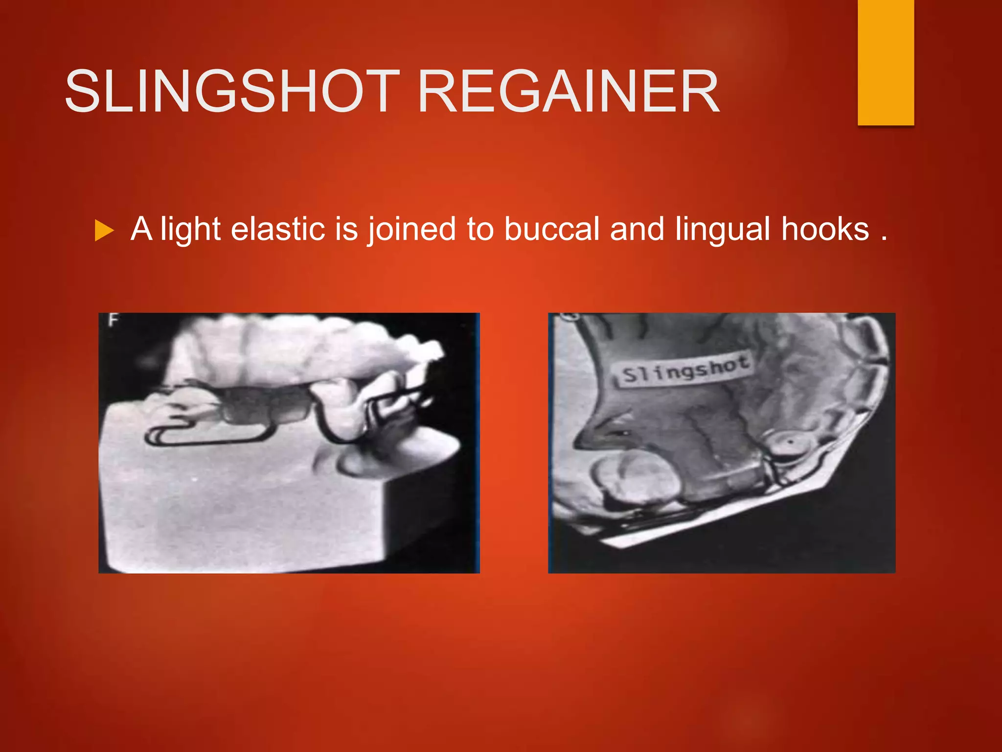 Space regainers | PPTX