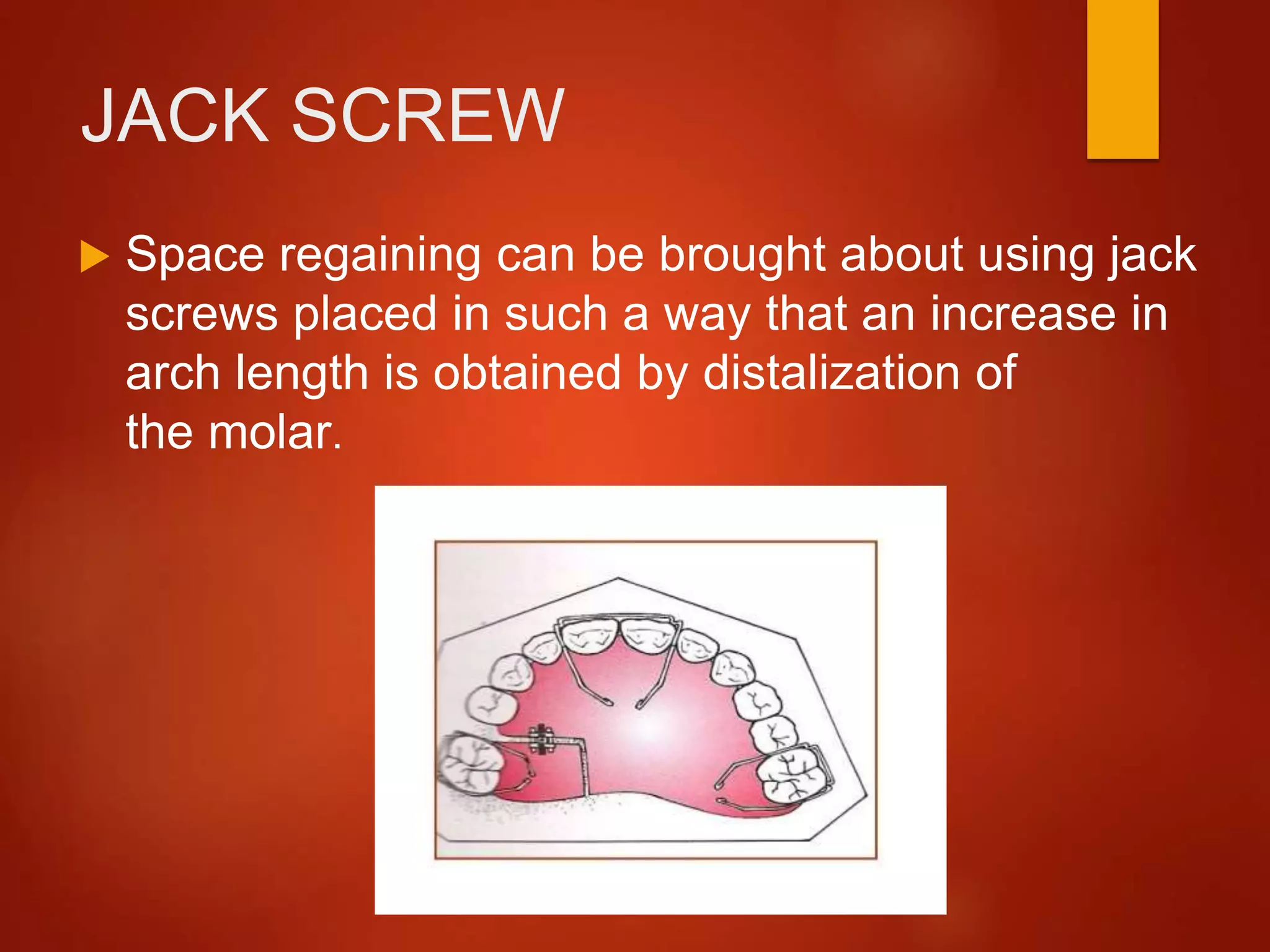 Space regainers | PPTX