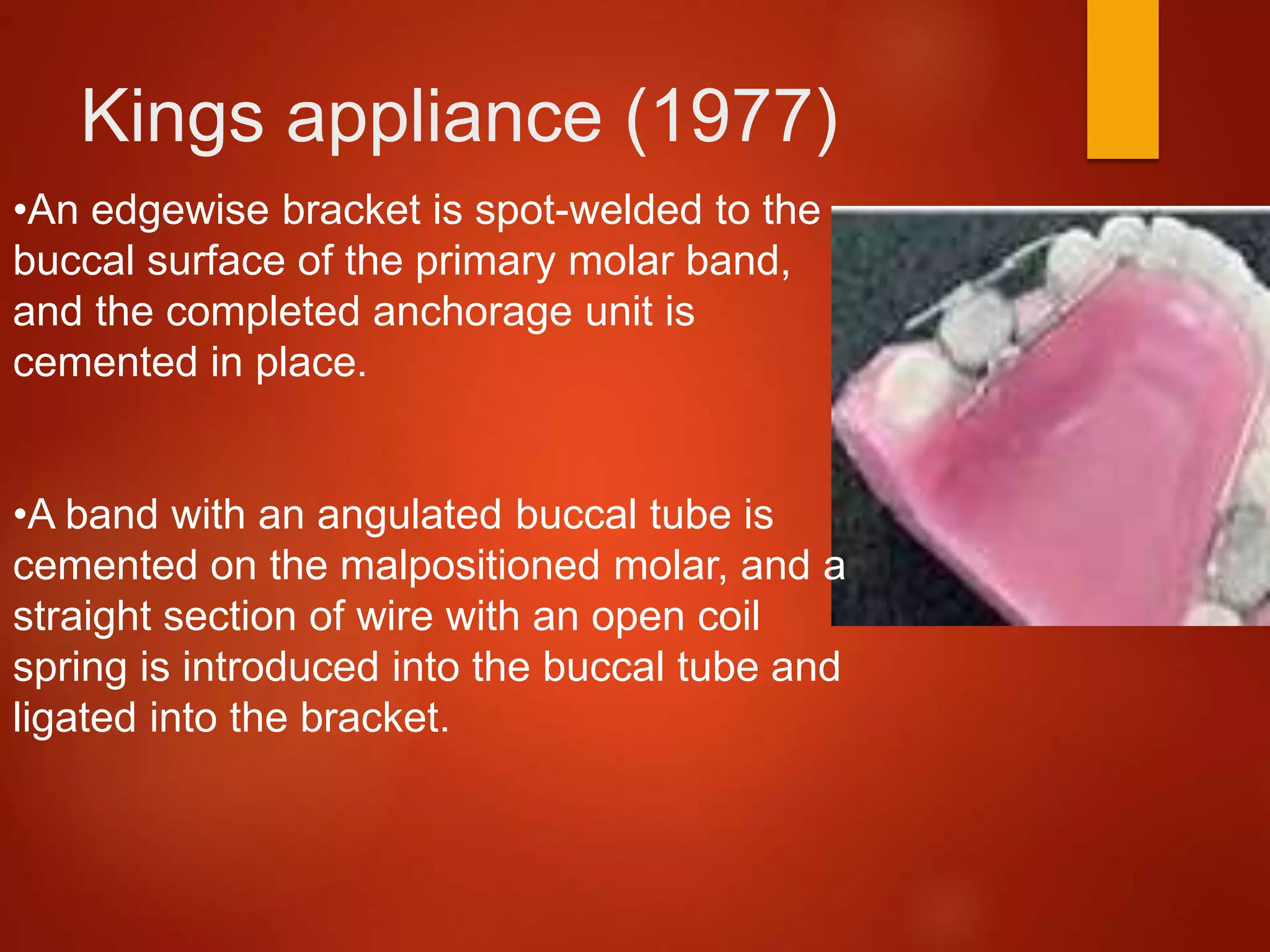 Space regainers | PPTX