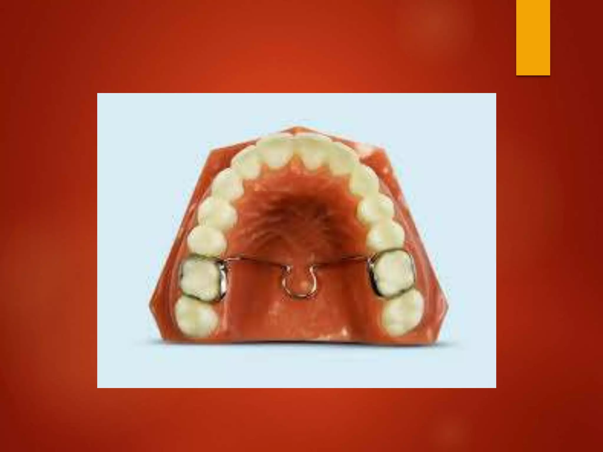 Space regainers | PPTX