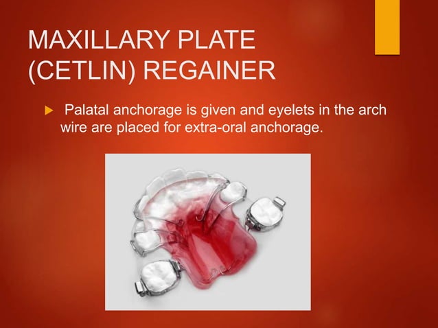 Space regainers | PPTX | Dental Health | Diseases and Conditions