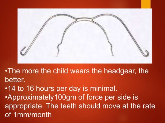 Space regainers | PPTX | Dental Health | Diseases and Conditions