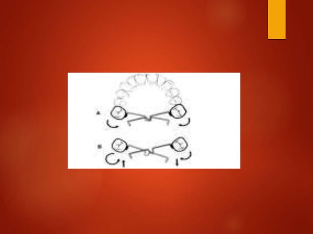 Space regainers | PPTX | Dental Health | Diseases and Conditions