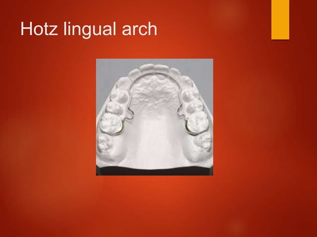 Space regainers | PPTX | Dental Health | Diseases and Conditions