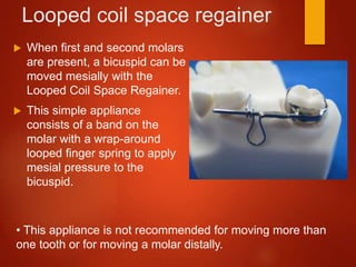 Space regainers | PPTX