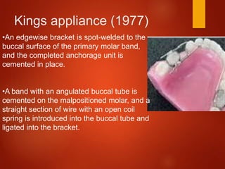 Space regainers | PPT