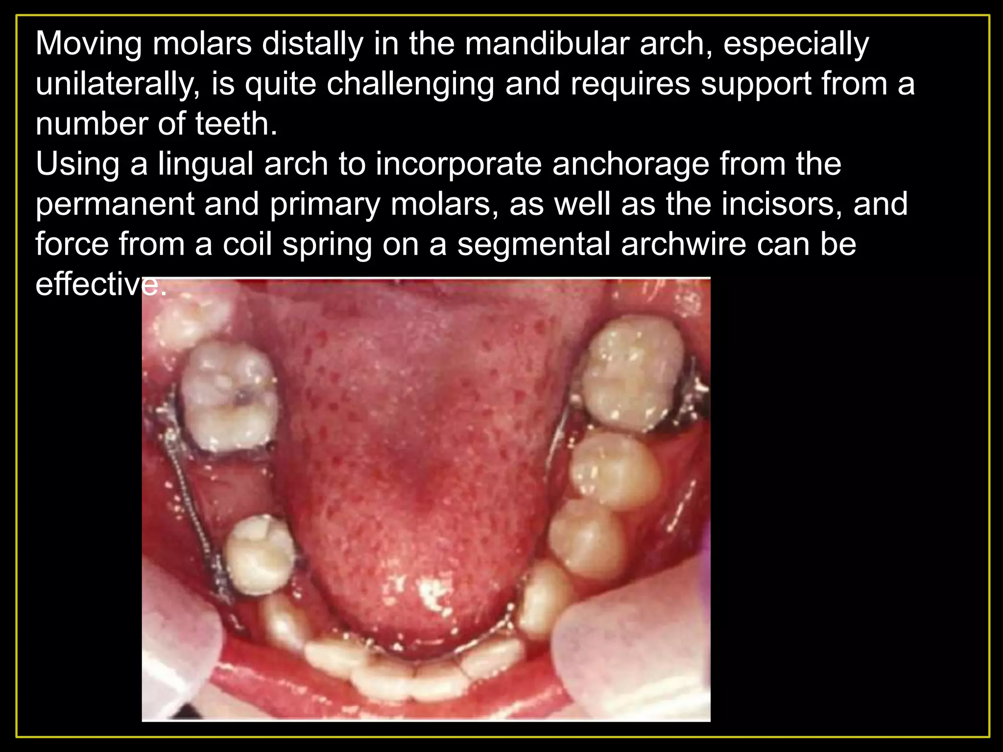 Space Regaining in Orthodontics | PPTX