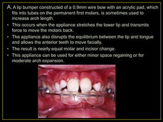 Space Regaining in Orthodontics | PPTX