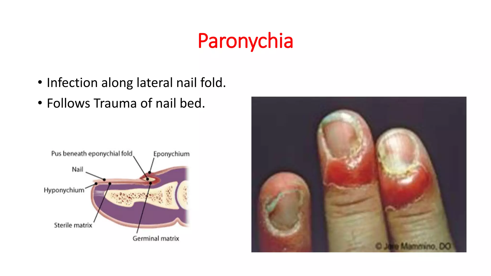 Spaces of Hand and Forearm | PPTX