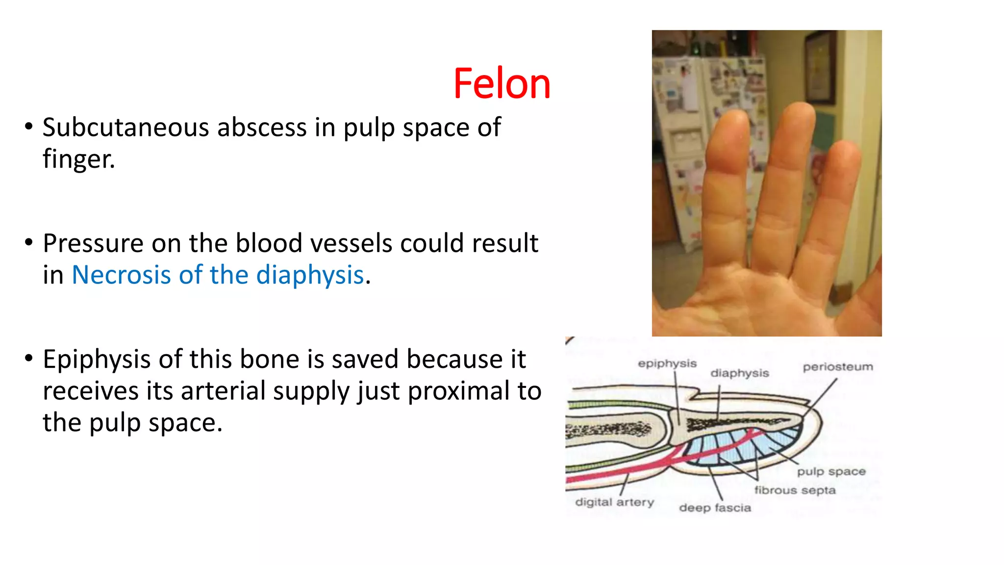 Spaces of Hand and Forearm | PPTX