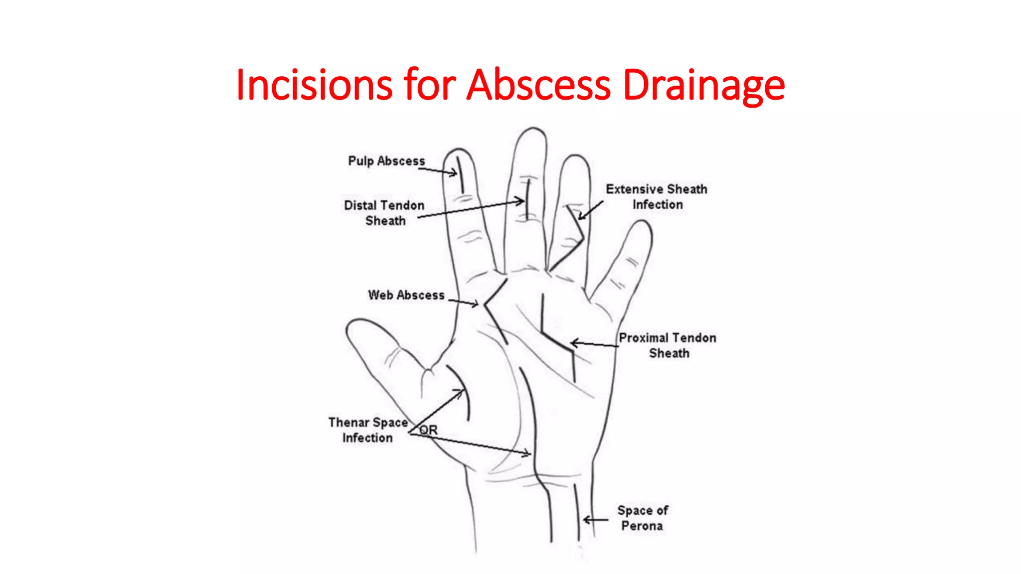 Spaces of Hand and Forearm | PPTX