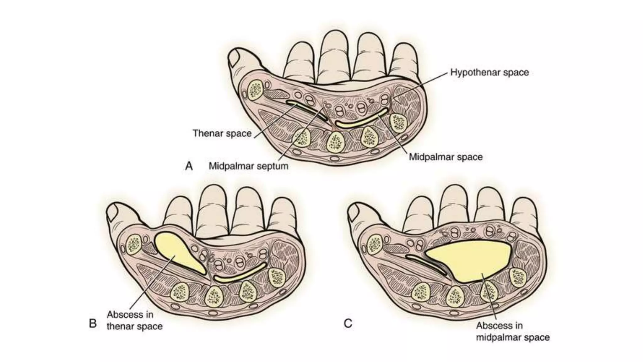 Spaces of Hand and Forearm | PPTX