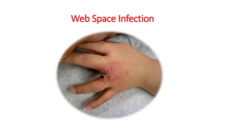 Spaces of Hand and Forearm | PPTX