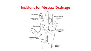 Spaces of Hand and Forearm | PPTX